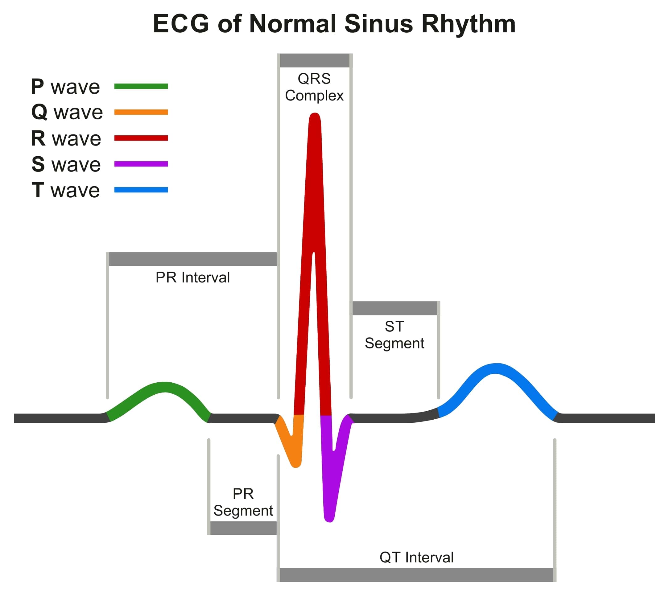 Sinus Rhythm - OT&P Knowledgebase